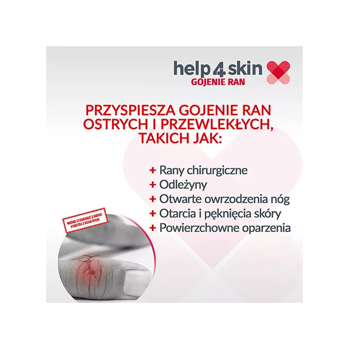 Help4skin - gojenie ran, spray-żel hydrokolopidowy przyspieszający ...